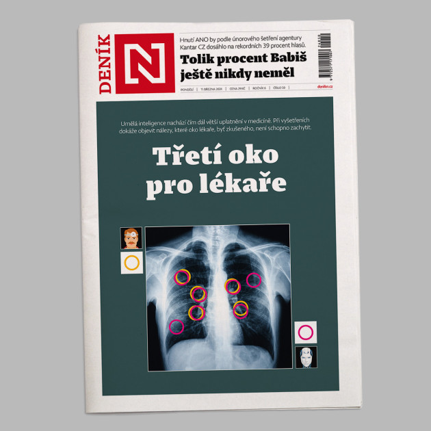 titulka-DN240311-web-site-ai-diagnostika-rentgen-lekar.jpg?w=1200&h=630 ...